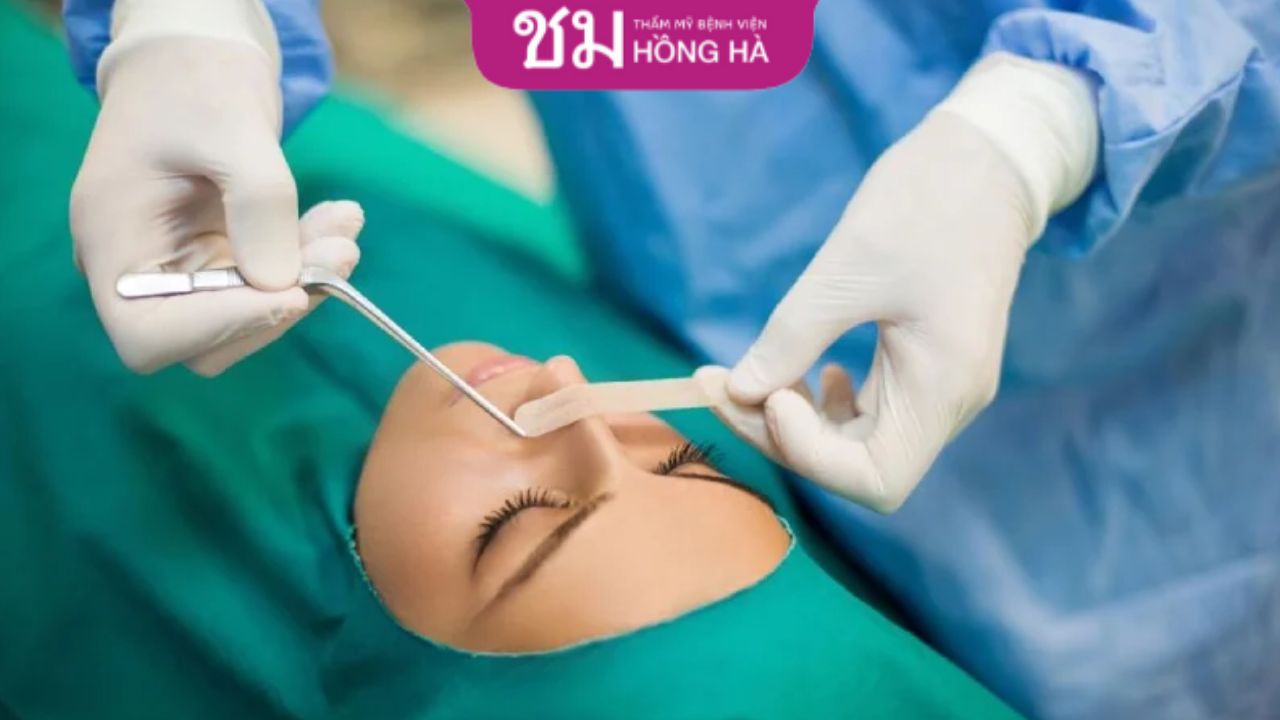 Làm mũi có đau không - 3 yếu tố ảnh hưởng trực tiếp khi làm mũi